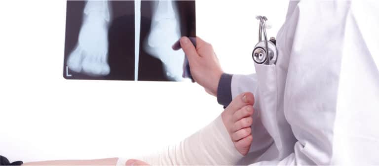 Emergency Breaks and Sprains | No Wait ER | The Emergency Center